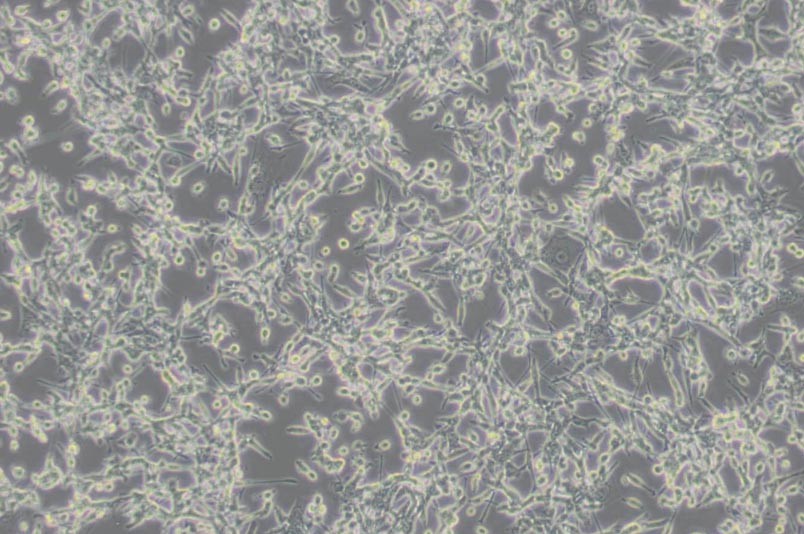 CT26.WT小鼠结肠癌细胞价格-CT26.WT小鼠结肠癌细胞说明书-上海通蔚实业有限公司