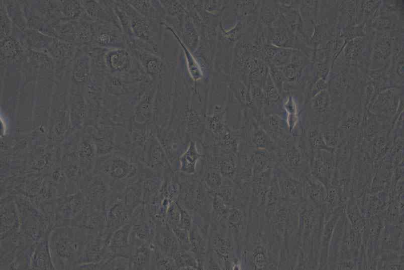 MC3T3-E1 Subclone 24小鼠胚胎成骨细胞前体细胞价格-MC3T3-E1 Subclone 24小鼠胚胎成骨细胞前体细胞说明书-上海通蔚实业有限公司