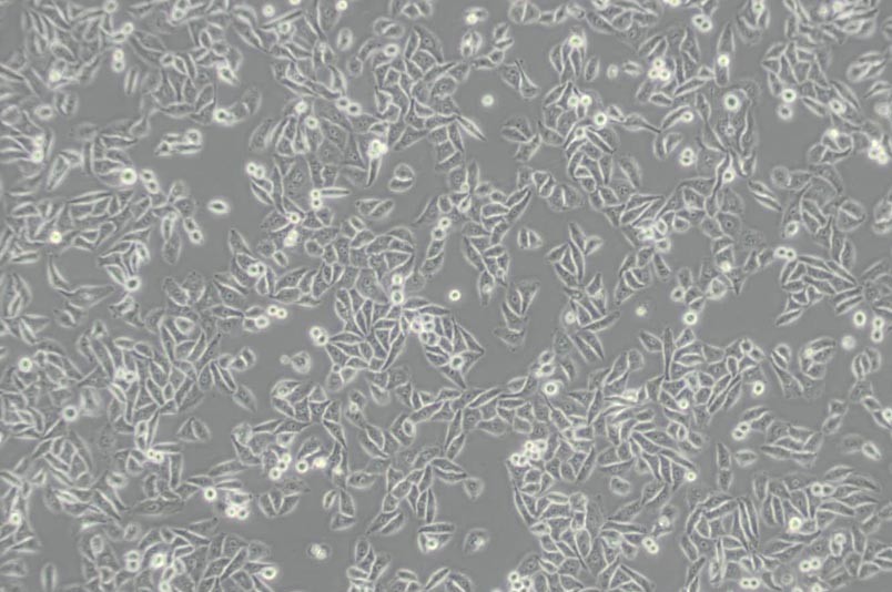 SK-OV-3人卵巢癌细胞价格-SK-OV-3人卵巢癌细胞说明书-上海通蔚实业有限公司