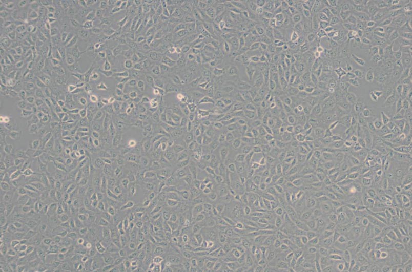 ARPE-19人视网膜上皮细胞价格-ARPE-19人视网膜上皮细胞说明书-上海通蔚实业有限公司