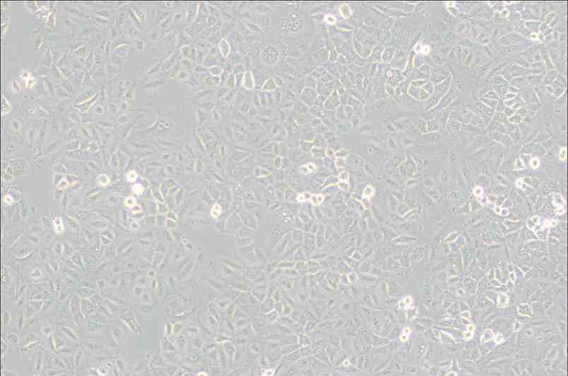 A549[A-549]人非小细胞肺癌细胞价格-A549[A-549]人非小细胞肺癌细胞说明书-上海通蔚实业有限公司